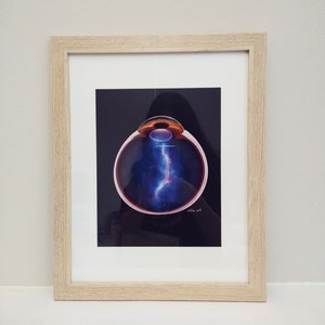Starry Eyes Print Optometry / Ophthalmology Print Unique Eyeball Art - Etsy