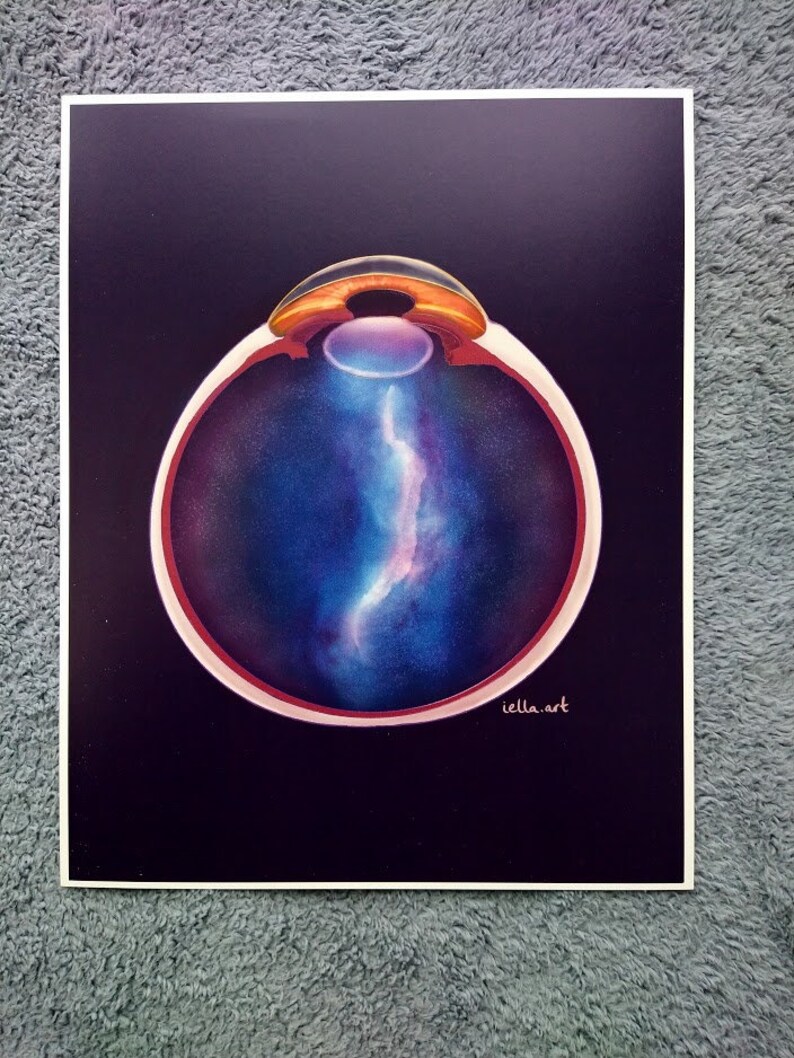 Starry Eyes Print Optometry / Ophthalmology Print Unique Eyeball Art - Etsy