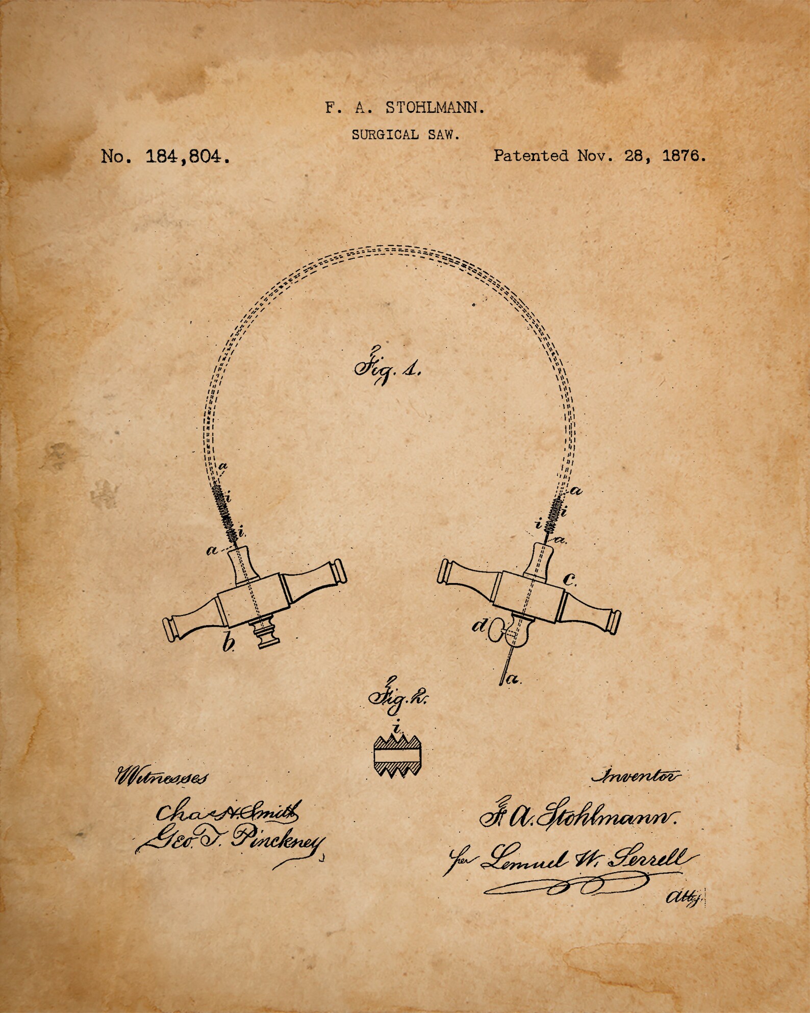 Medical Device Patent Medical Poster Medical Office Art - Etsy
