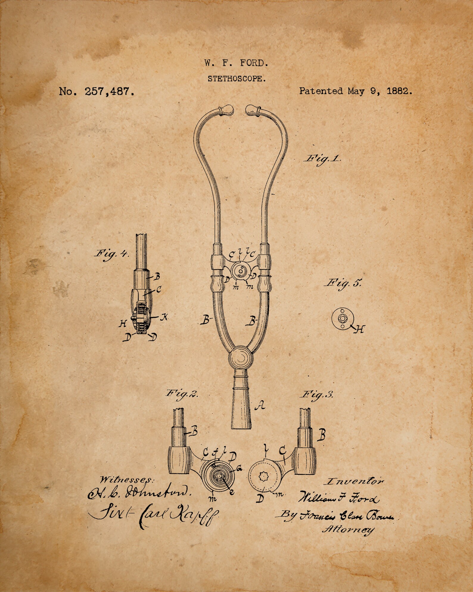 Medical Device Patent Medical Poster Medical Office Art - Etsy