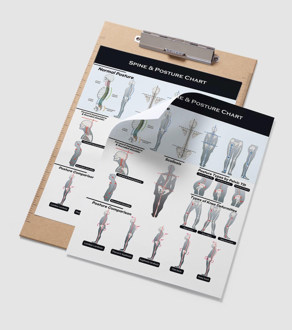 Spine & Posture Chart: Anatomy Poster for Chiropractic, Physical ...