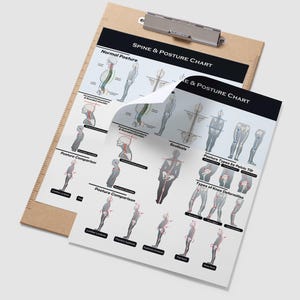 Spine & Posture Chart: Anatomy Poster for Chiropractic, Physical ...