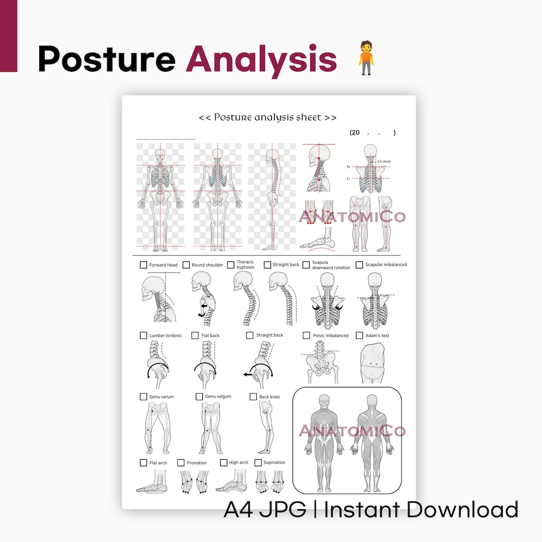 Posture Analysis Chart – Printable A4 JPG | Body Alignment Assessment ...