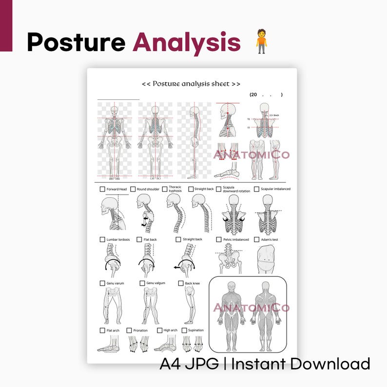 Posture Analysis Chart – Printable A4 JPG | Body Alignment Assessment ...