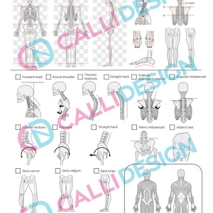Posture Analysis Chart – Printable A4 JPG | Body Alignment Assessment ...