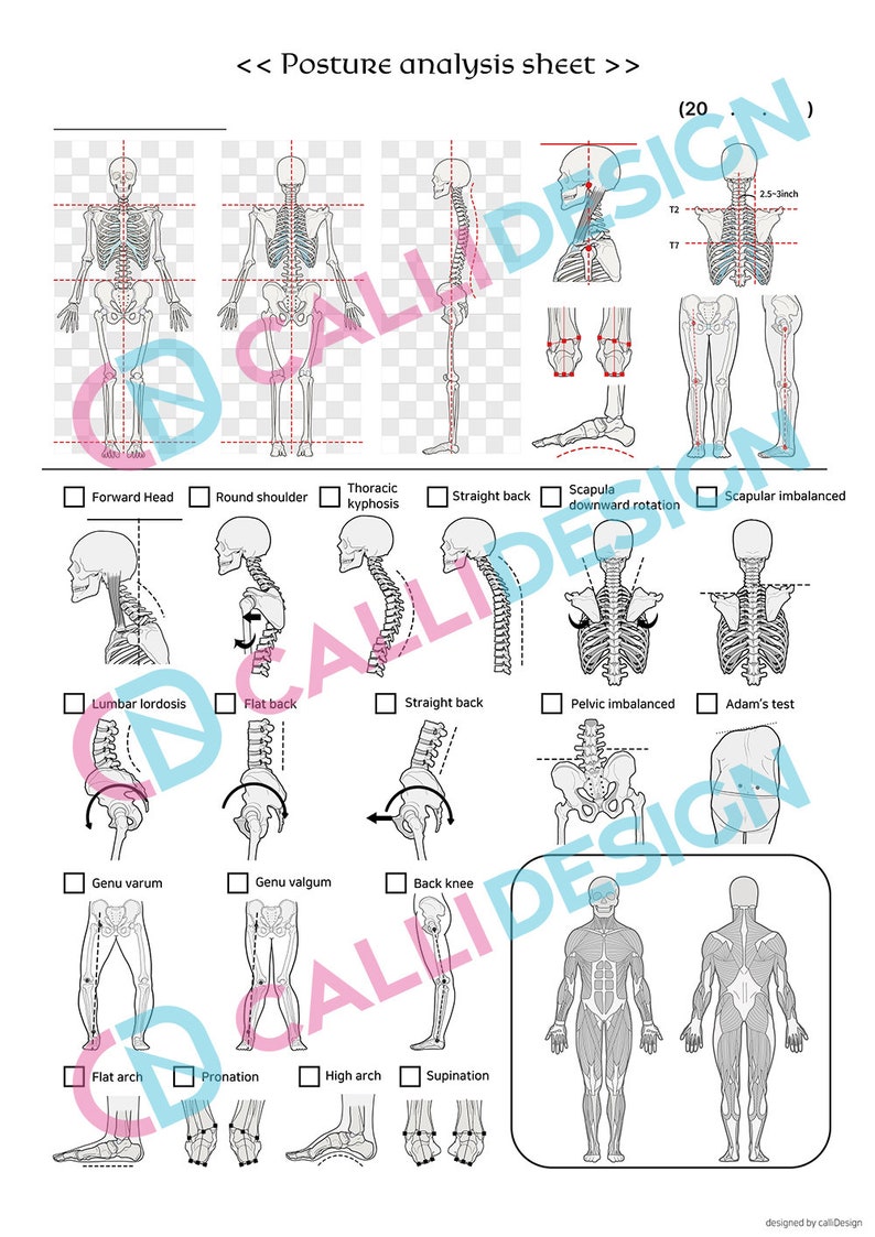 Posture Analysis Chart – Printable A4 JPG | Body Alignment Assessment ...