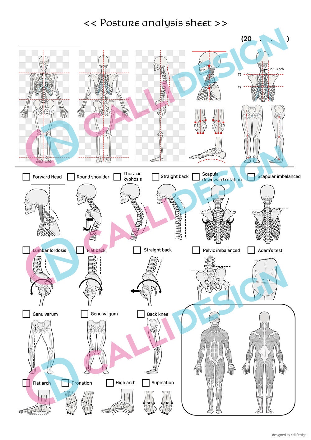 Posture Analysis Chart – Printable A4 JPG | Body Alignment Assessment ...