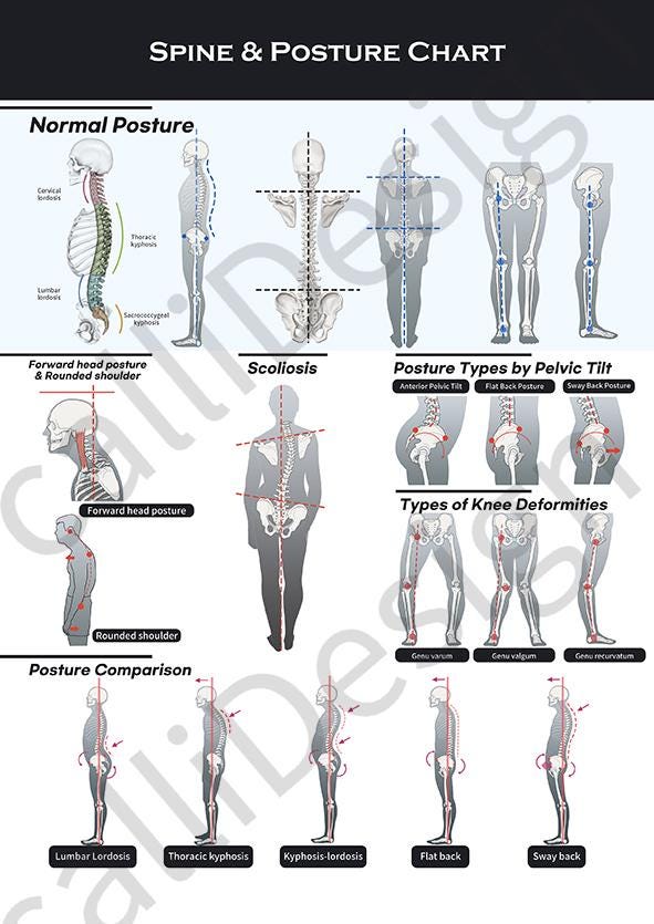 Spine & Posture Chart: Anatomy Poster for Chiropractic, Physical ...