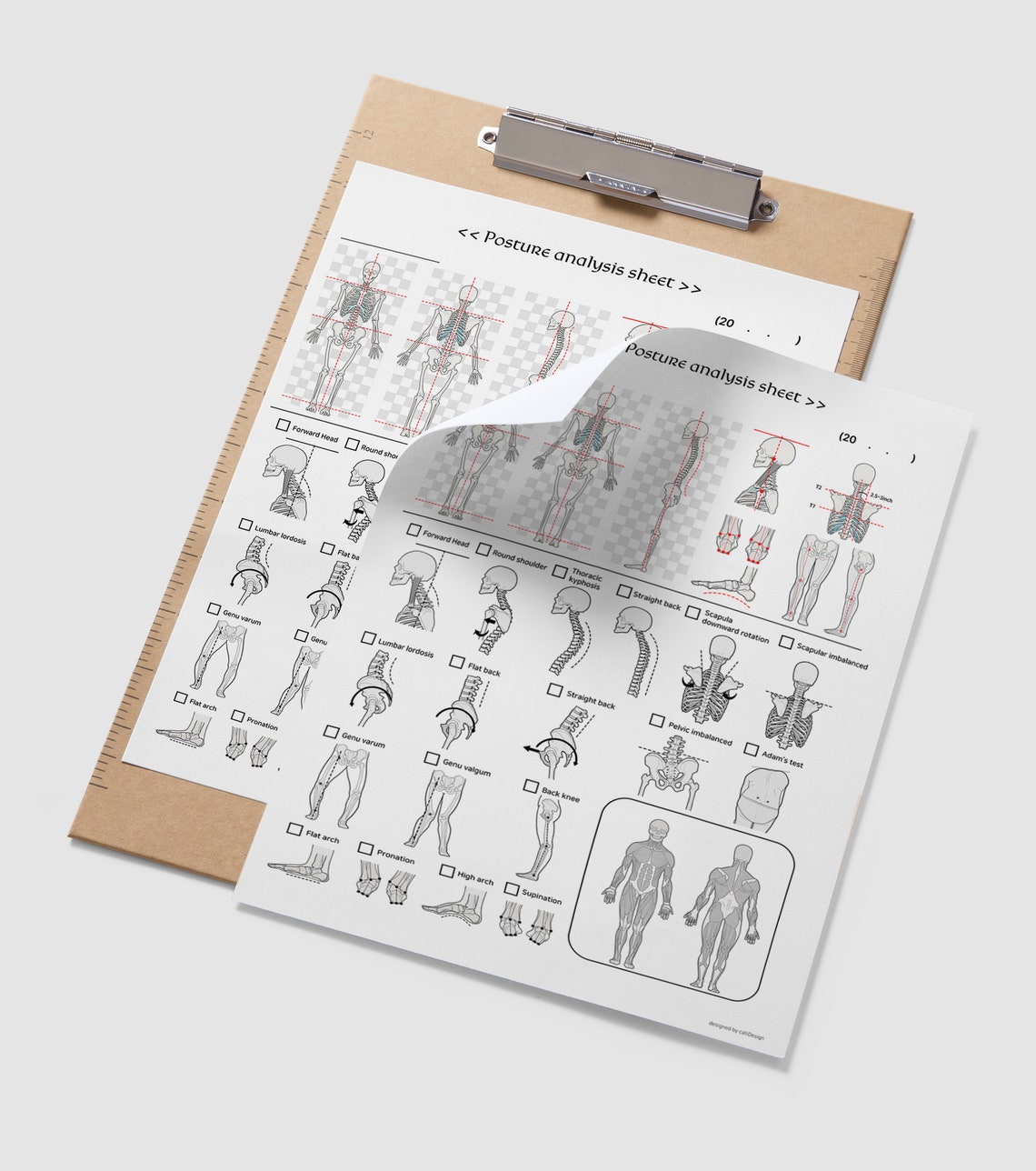 Posture Analysis Chart – Printable A4 JPG | Body Alignment Assessment ...