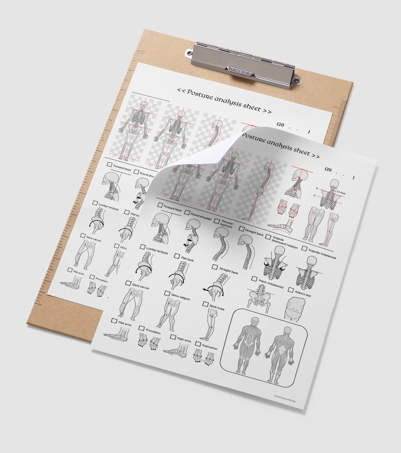 Posture Analysis Chart – Printable A4 JPG | Body Alignment Assessment ...