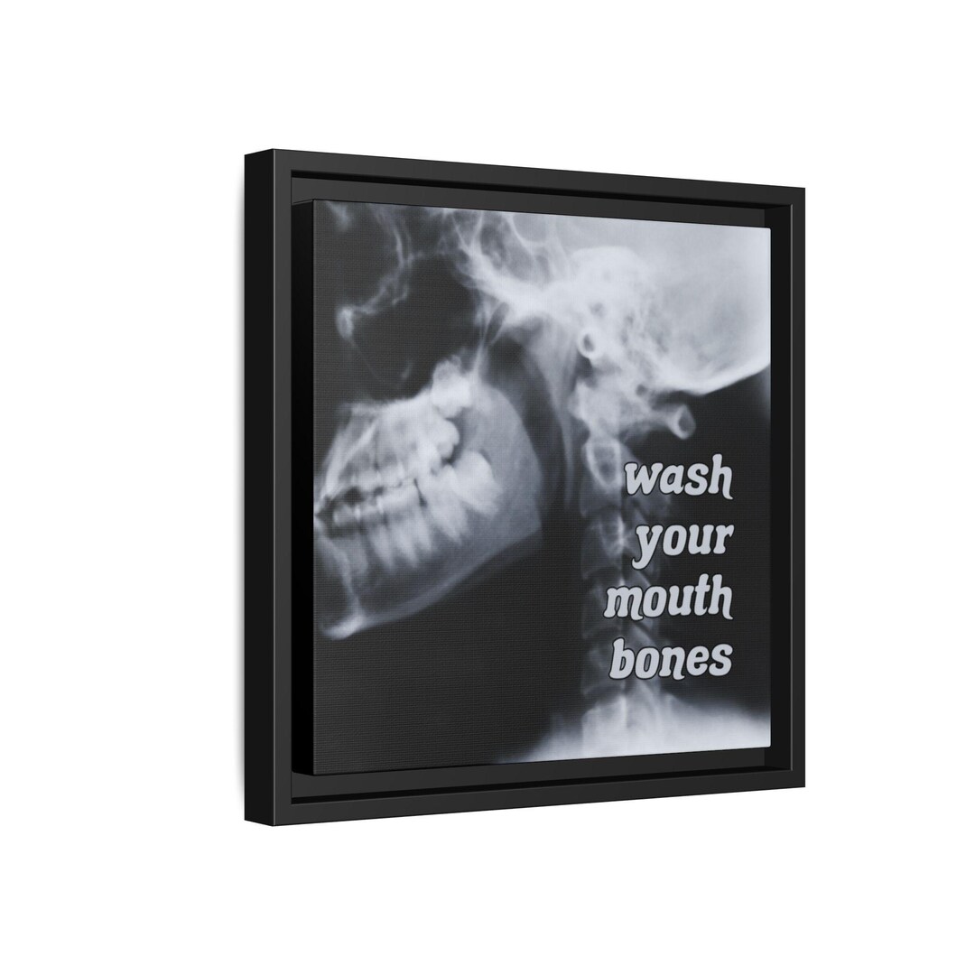 Wash Your Mouth Bones X-ray Skull Teeth Framed Art Print, Funny Wall ...