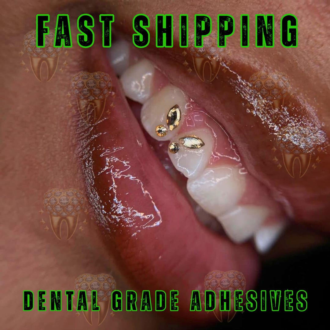 Tooth Gem Business Starter Bundle - Etsy