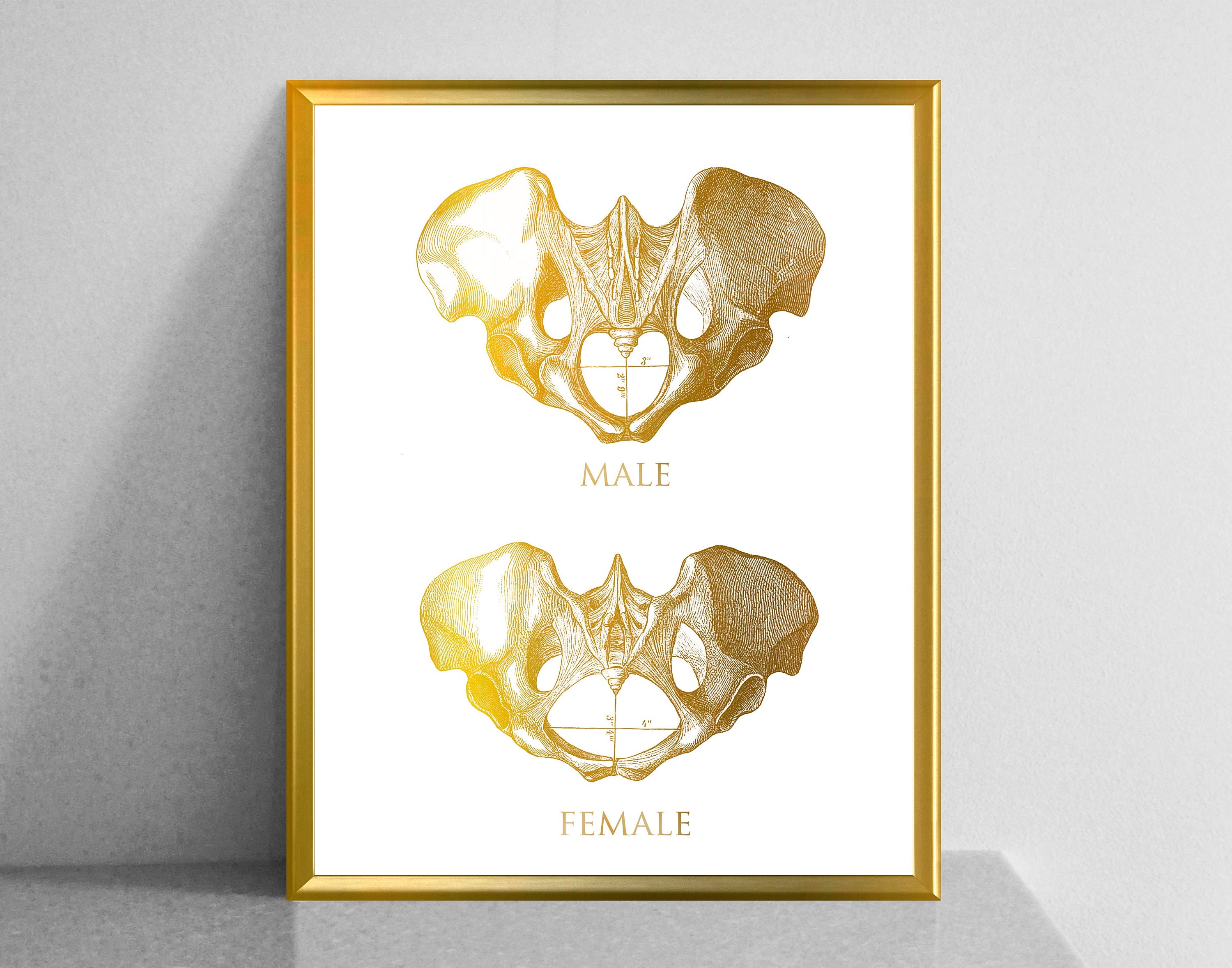 Male Vs Female Pelvis Differences Anatomy of Skeleton Posters | Etsy