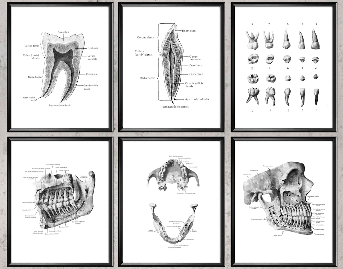 6 Dental Anatomy Posters Dentistry Art Dentist Office Decor ...