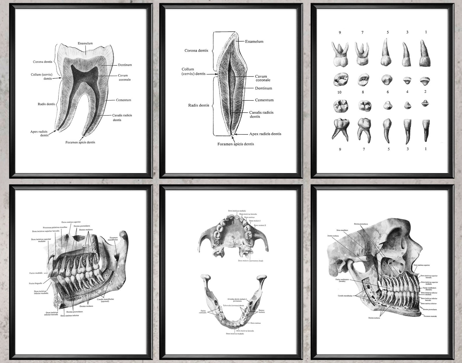 6 Dental Anatomy Posters Dentistry Art Dentist Office Decor ...