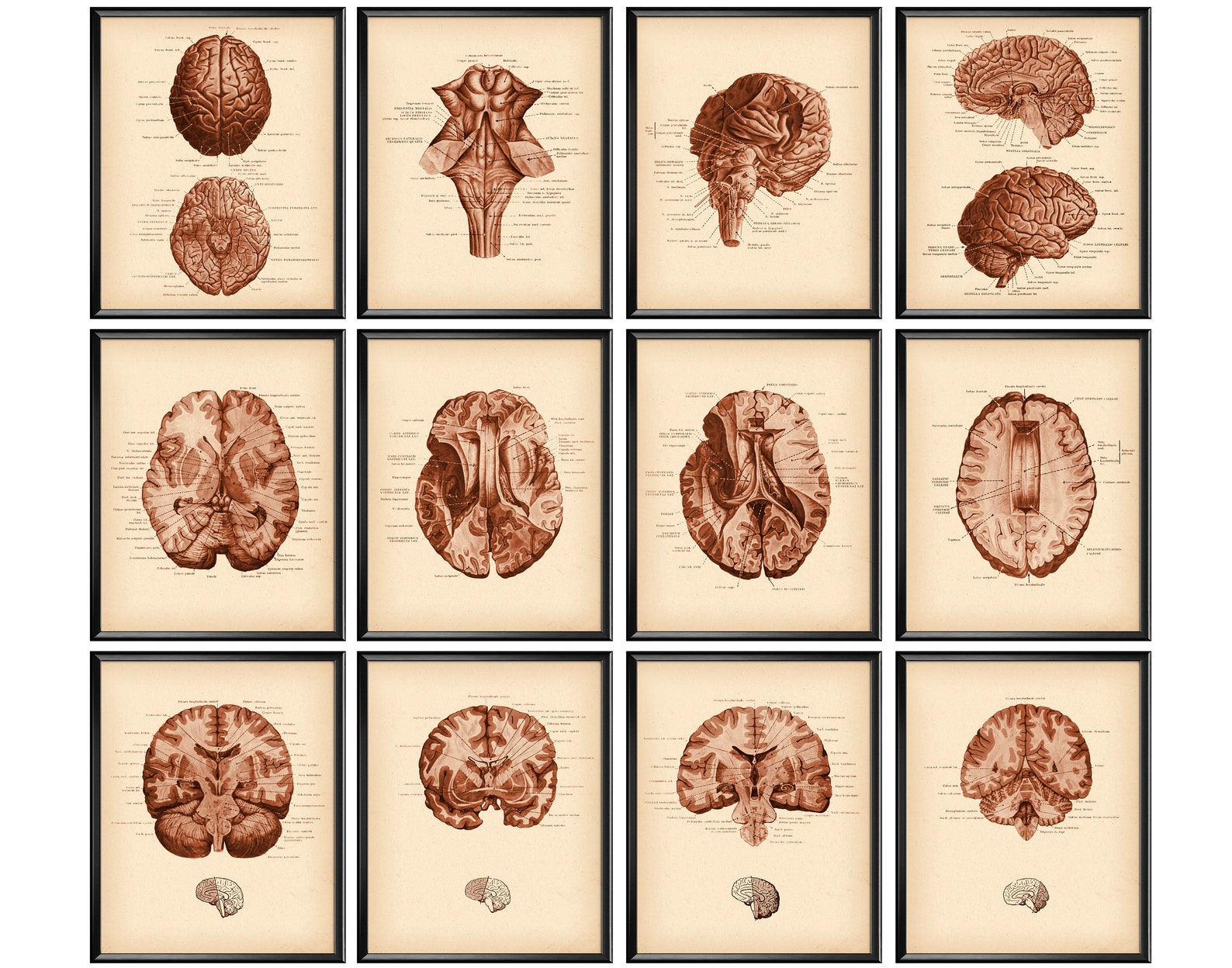 Neurology Vintage Posters Anatomy Art Anatomical Brain - Etsy