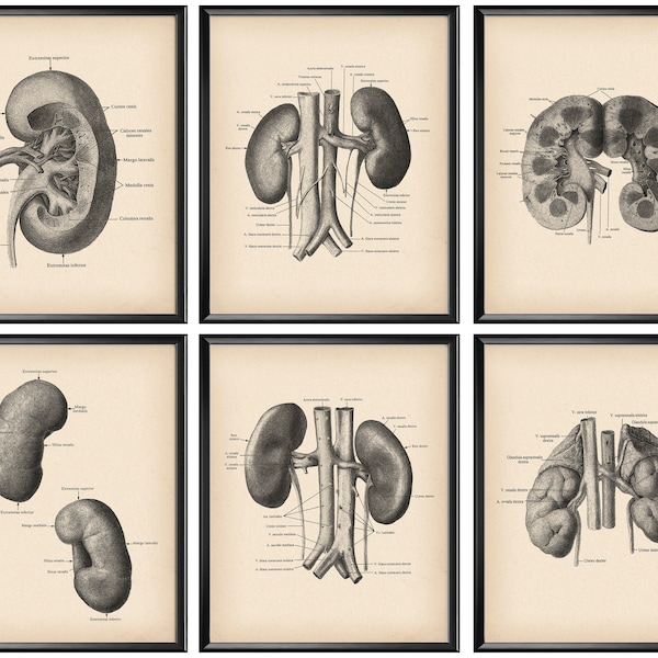 Kidney Anatomy Poster - Etsy