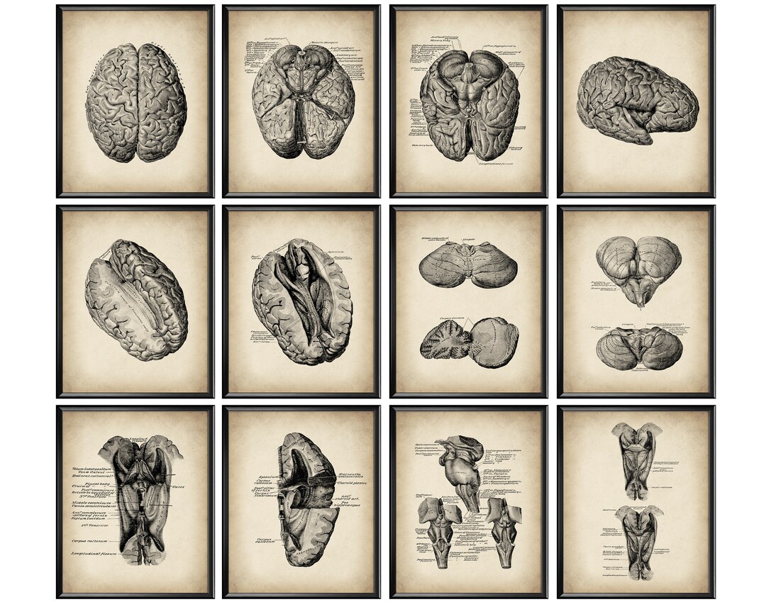 12 Vintage Brain Anatomy Posters Neurology Art Medical Art Science Art ...