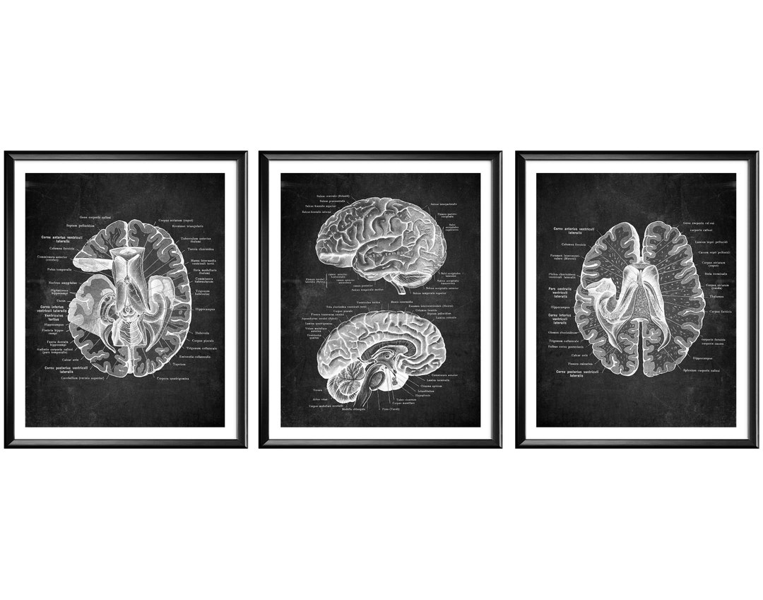 Anatomical Brain Poster Neurology Chalkboard Art Human Brain Structure ...