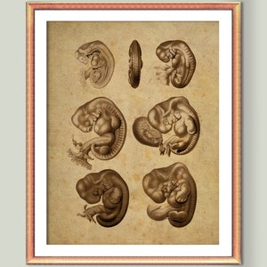 Obgyn Vintage Posters Fetus in Womb Antique Illustration Embryo ...