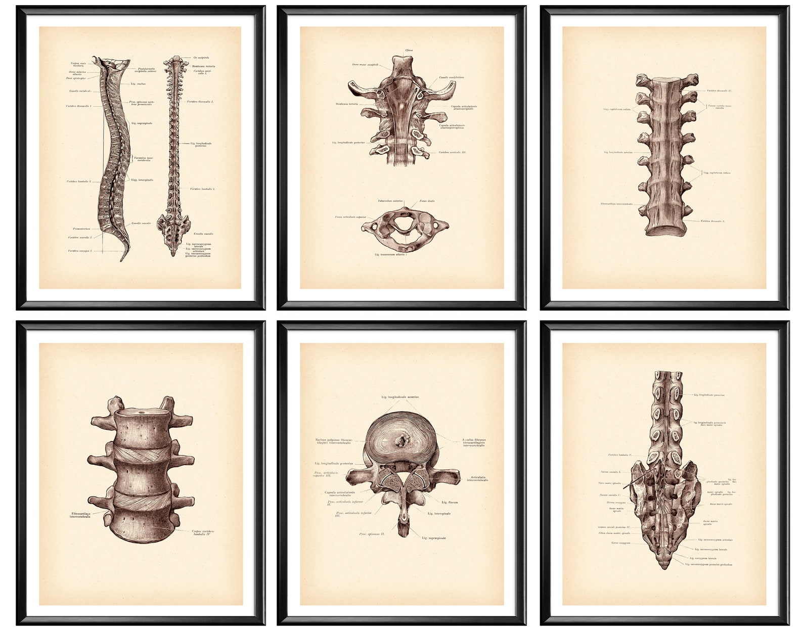 Spinal Anatomy Print, Vertebral Column, Vertebral Structure Vintage ...