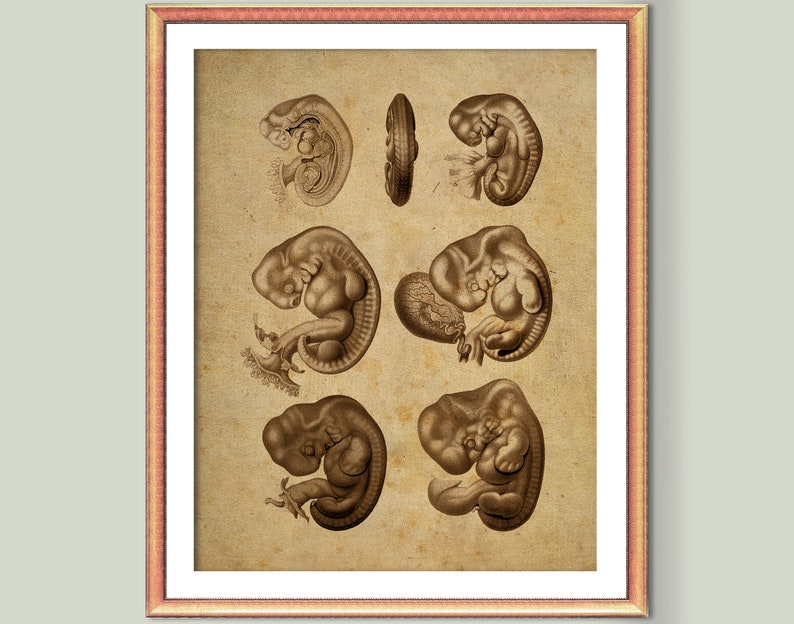 Embryo Development Vintage Poster Fetal Structure Print | Etsy