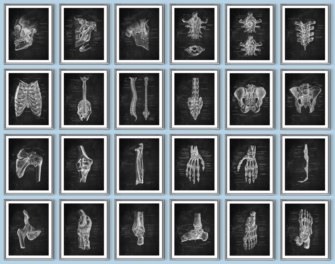 24 Orthopedic Anatomy Posters Skeletal Anatomy Art Human Skeleton ...