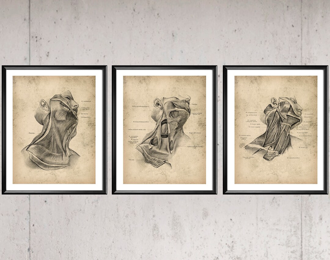 Human Neck Muscular System Anatomy Vintage Poster Surgery Art Medical ...