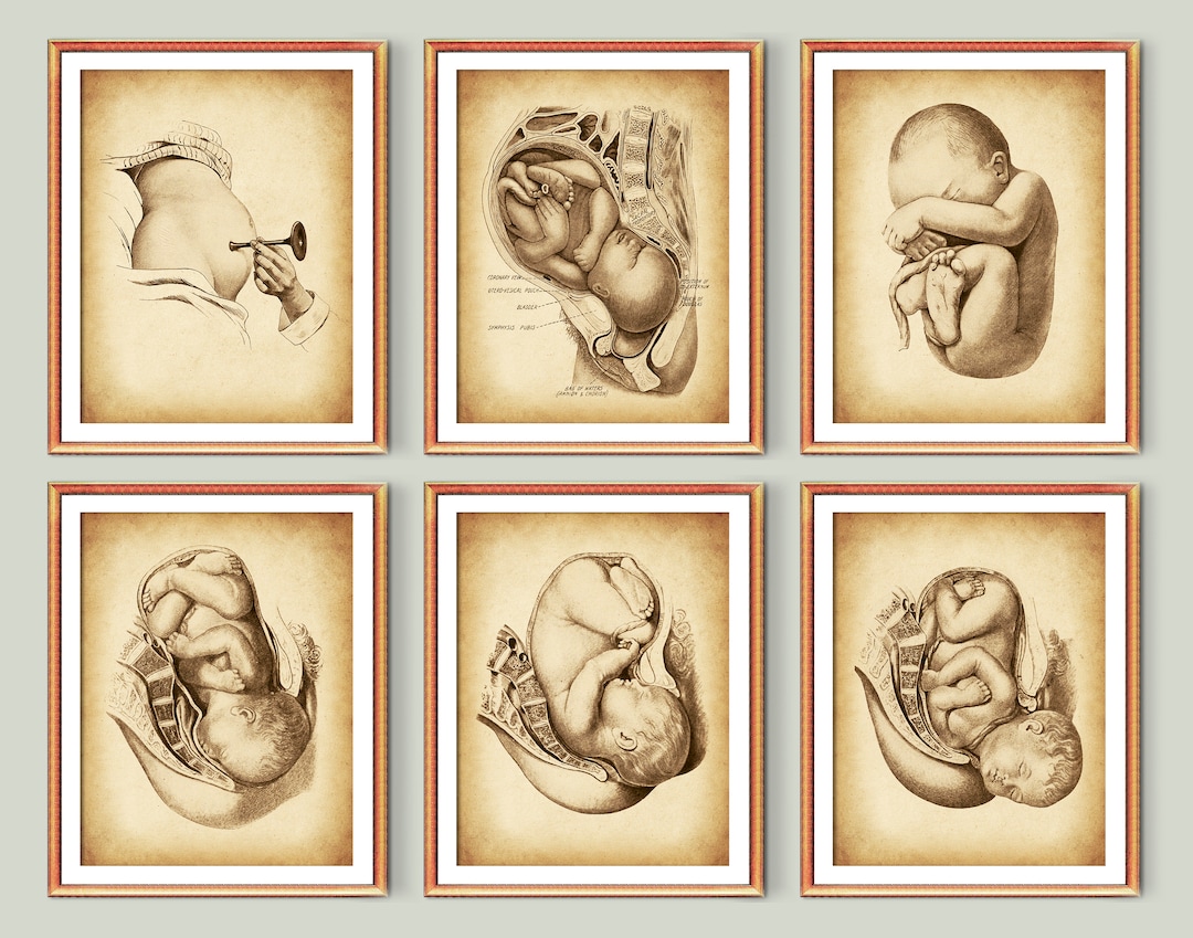 6 Vintage Pregnancy and Childbirth Art Obstetrics Art Pregnancy Care ...