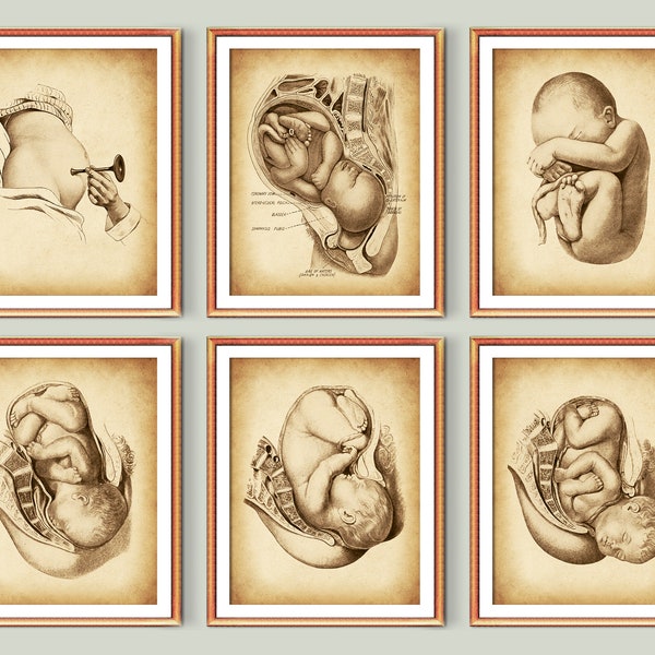 Fetus anatomy poster - Etsy Österreich