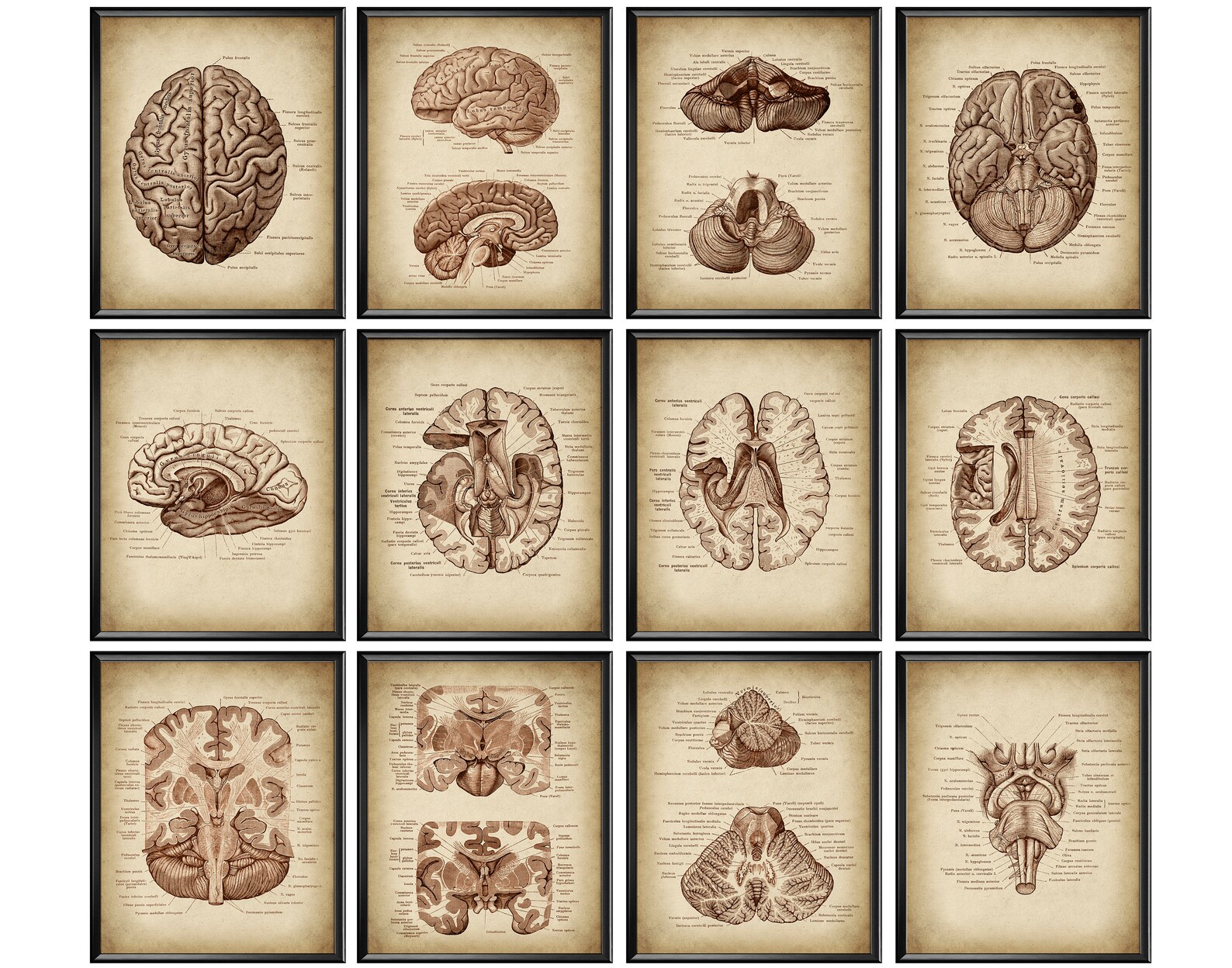 12 Human Anatomical Brain Posters Antique Neurology Art - Etsy