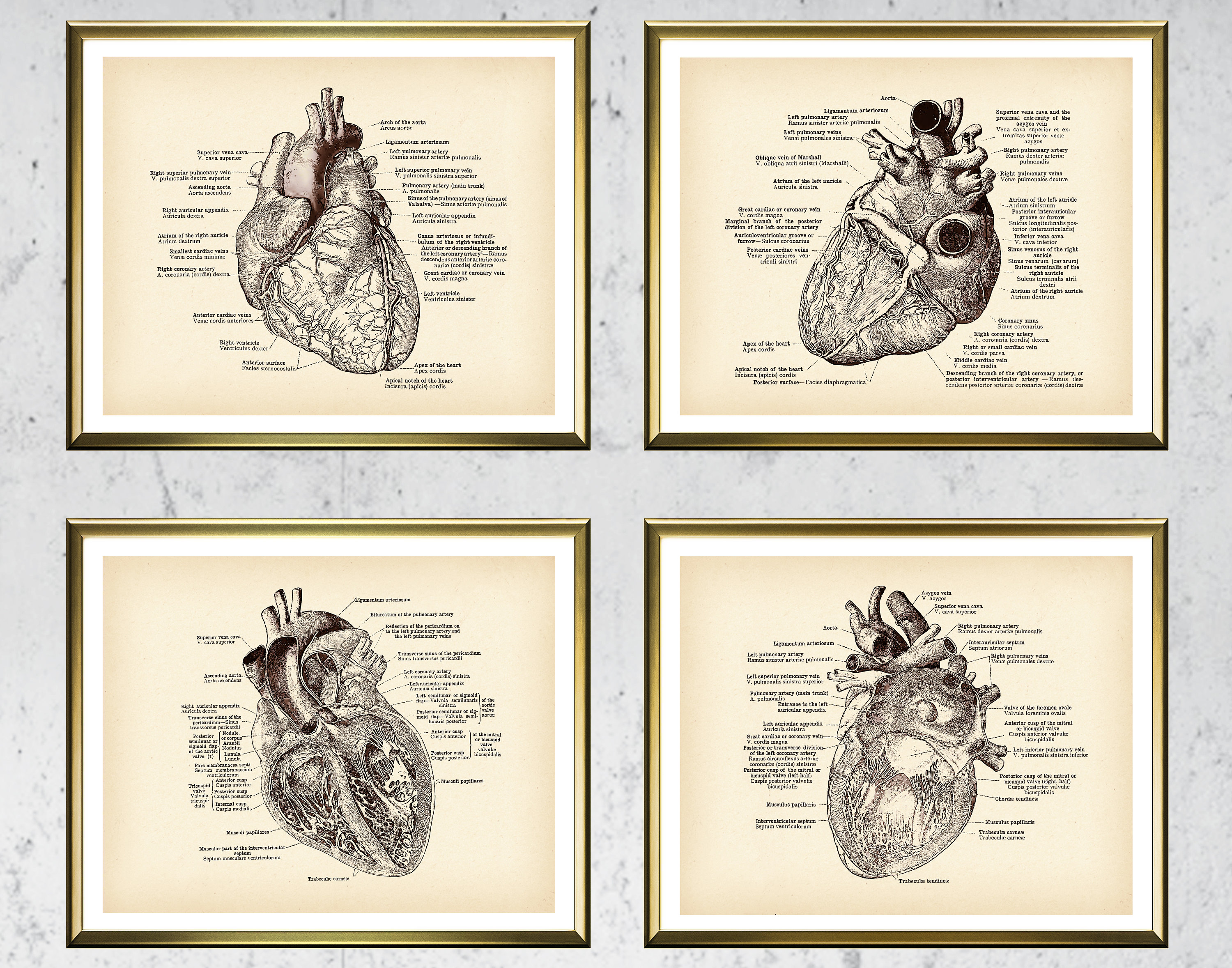 Human Anatomical Heart Vintage Poster Medical Art Antique | Etsy