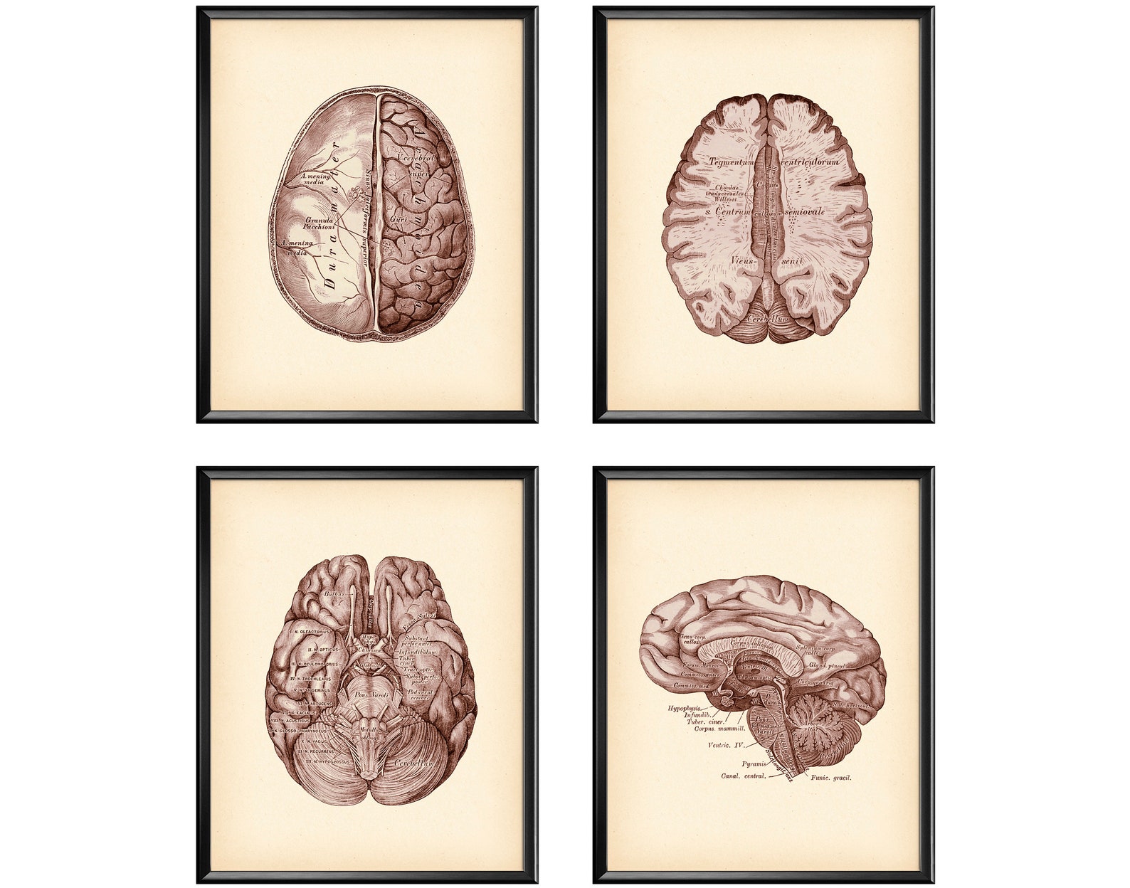 Antique Neurology Art Human Brain Anatomy Medical Art | Etsy