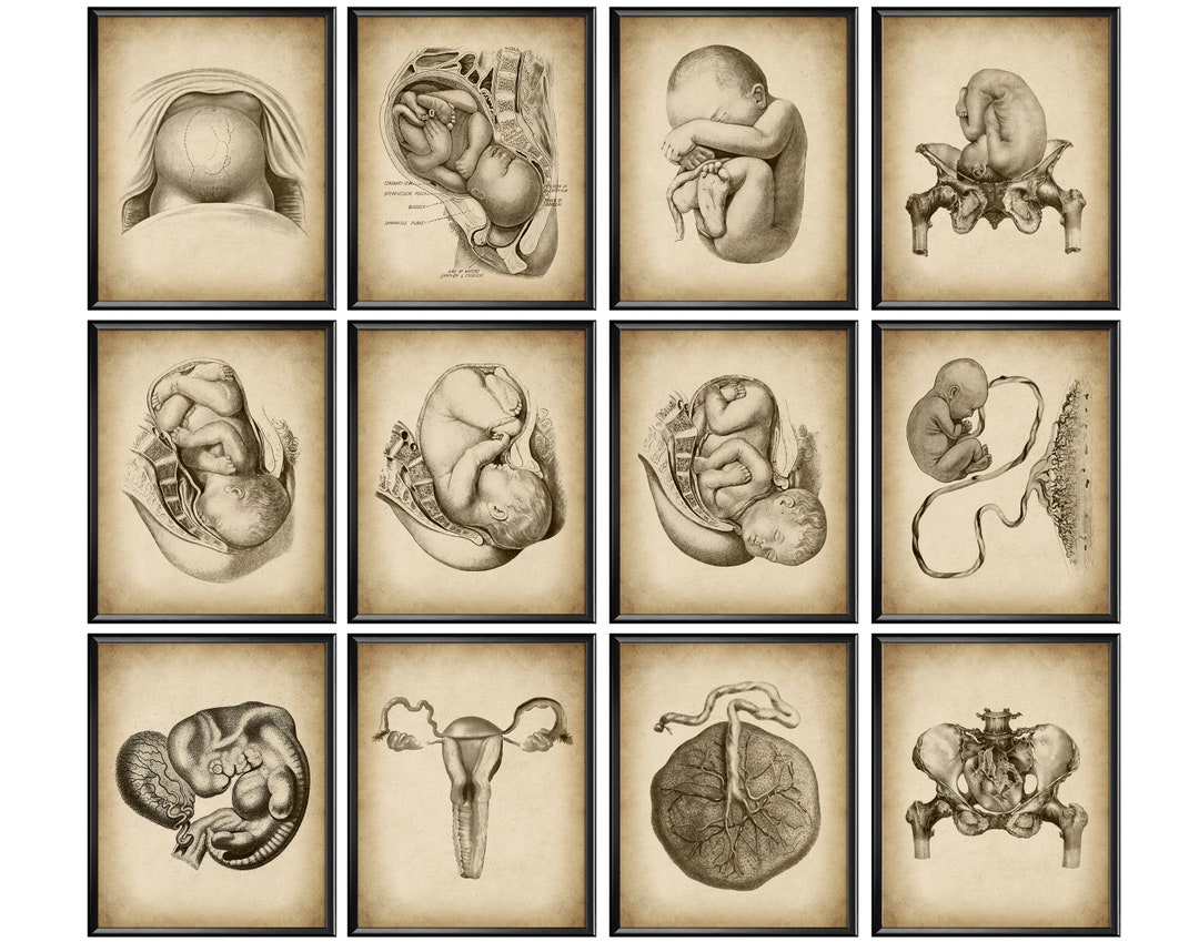 12 Vintage Pregnancy Art Obgyn Art Midwife Gift Gestation Art Anatomy ...