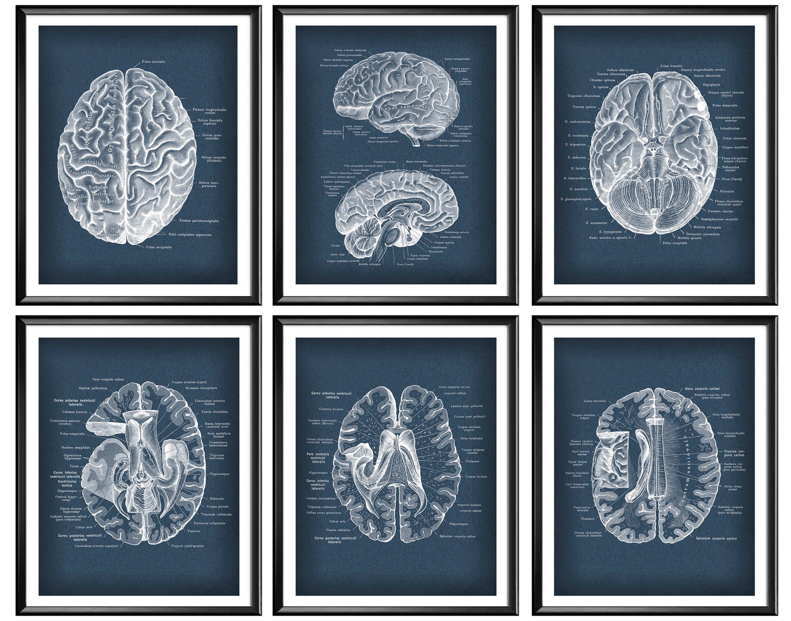 6 Neurology Posters Brain Anatomy Print Neuroscience Art - Etsy
