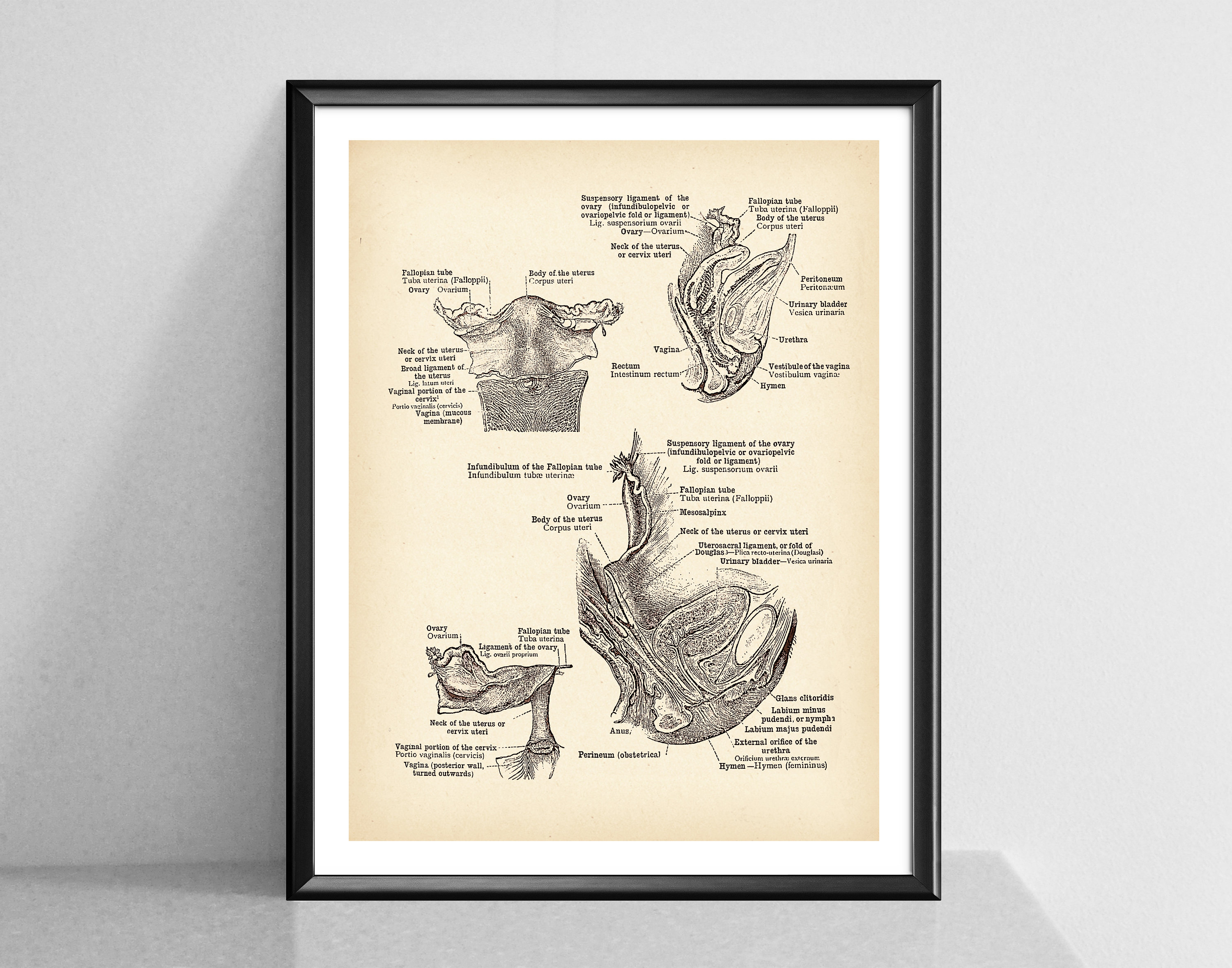Vagina Print Female Genital Organs Vintage Anatomy Poster - Etsy