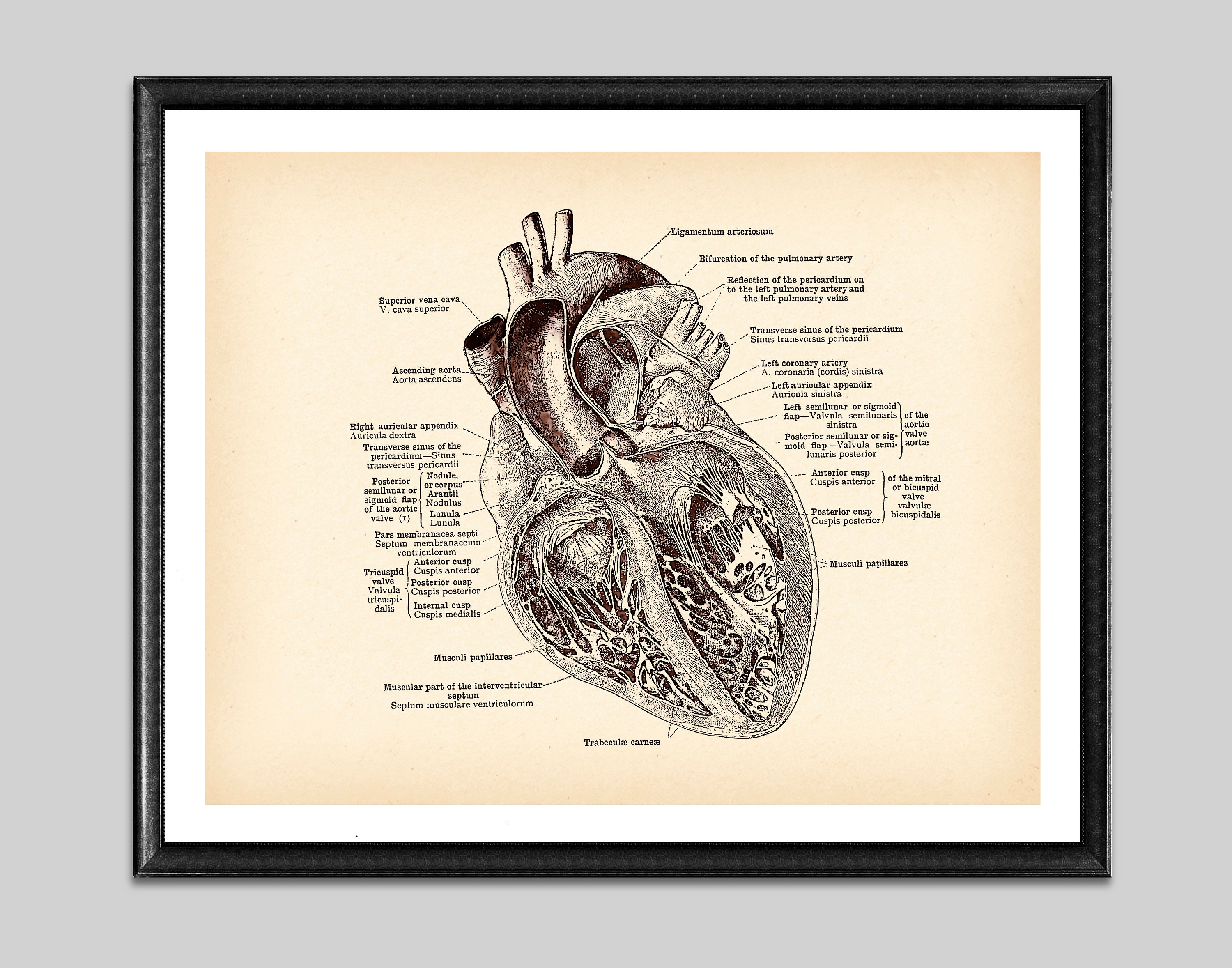 Human Anatomical Heart Vintage Poster Medical Art Antique - Etsy