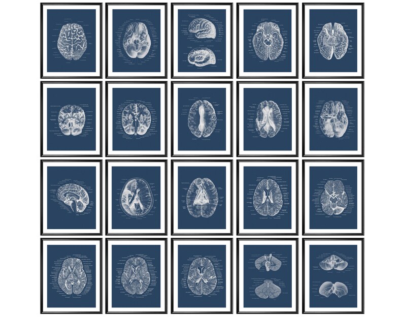 20 Neurology Art Brain Anatomy Art Cross Section Diagram Medical Decor ...