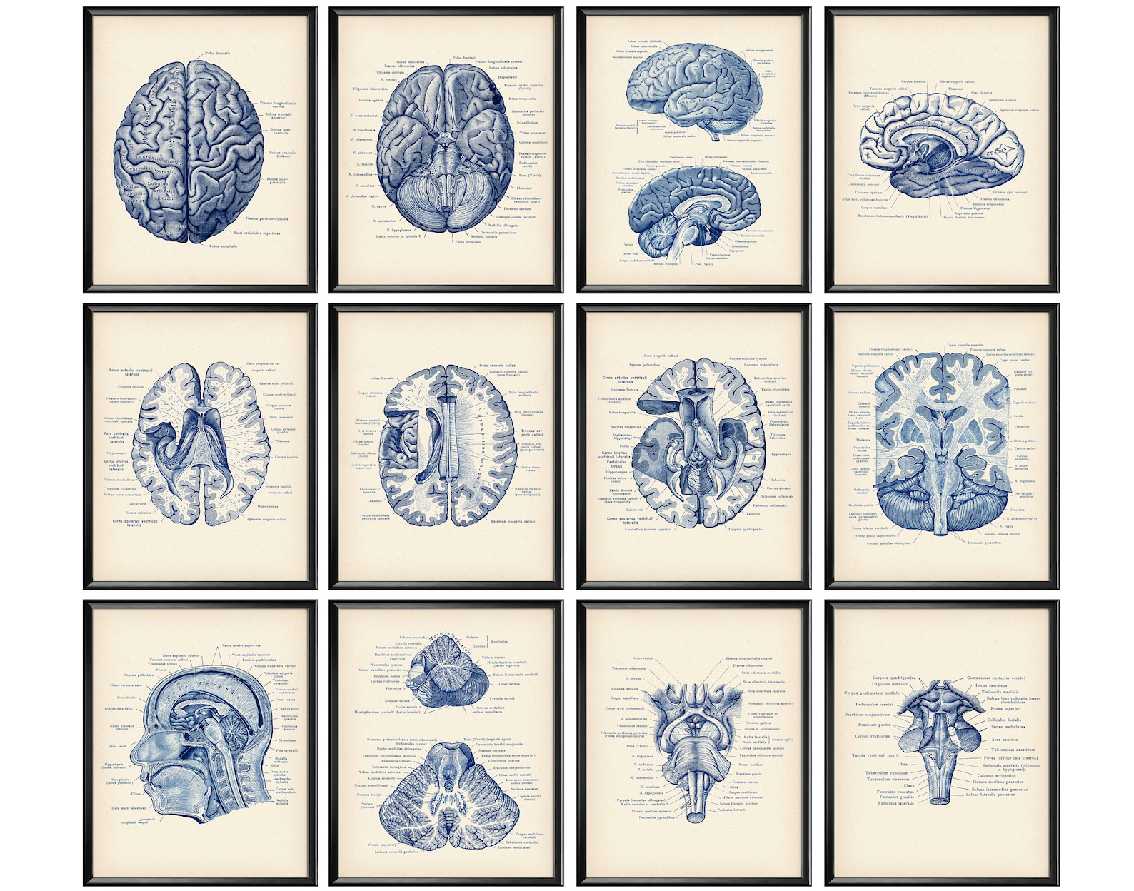 Neurology Vintage Art Anatomical Brain Poster Brain Anatomy - Etsy