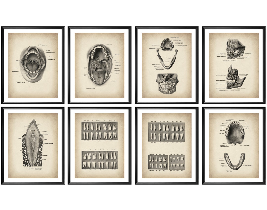 8 Antique Dental Posters, Medical Art, Dentist Gift, Orthodontist Gift ...