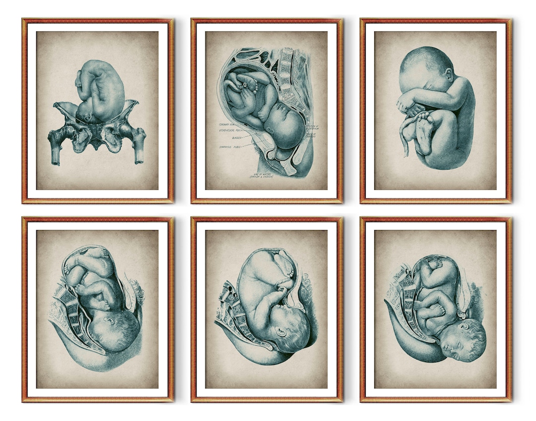 Set 6 of Vintage Childbirth Posters Anatomy Art Pregnancy Art Medical ...