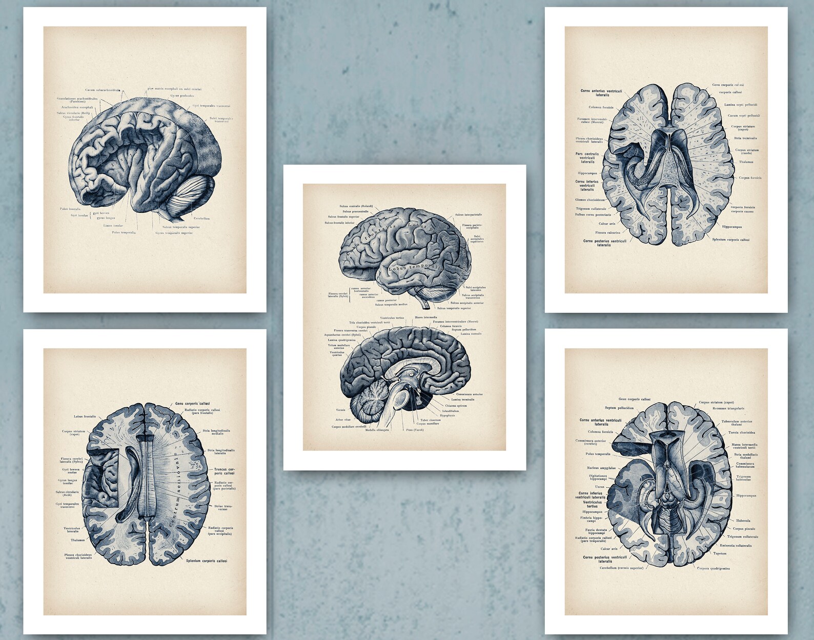 Human Brain Anatomy Poster Set Vintage Neurology Art Medical Art ...