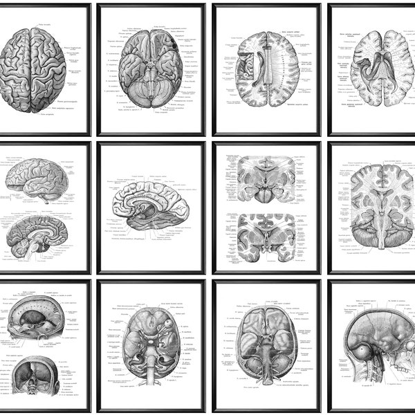 Human Brain Wall Art - Etsy