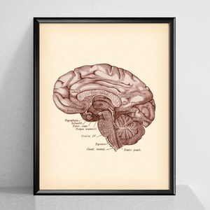 Antique Neurology Art, Human Brain Anatomy, Medical Art, Neurologist ...