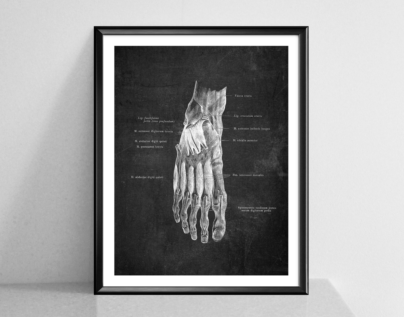 Foot Poster Bones and Muscles Anatomy Chalkboard Art Podiatry Art ...