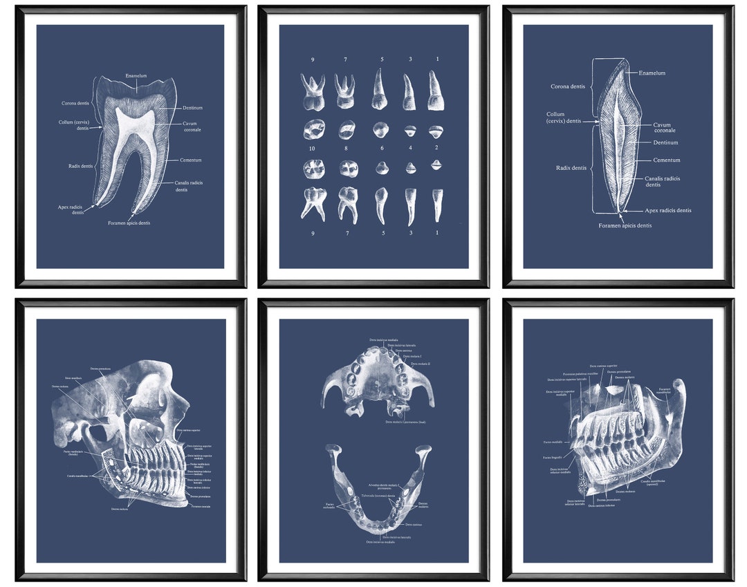 6 Orthodonture Art Dental Anatomy Posters Tooth Anatomy Diagram Dentist ...