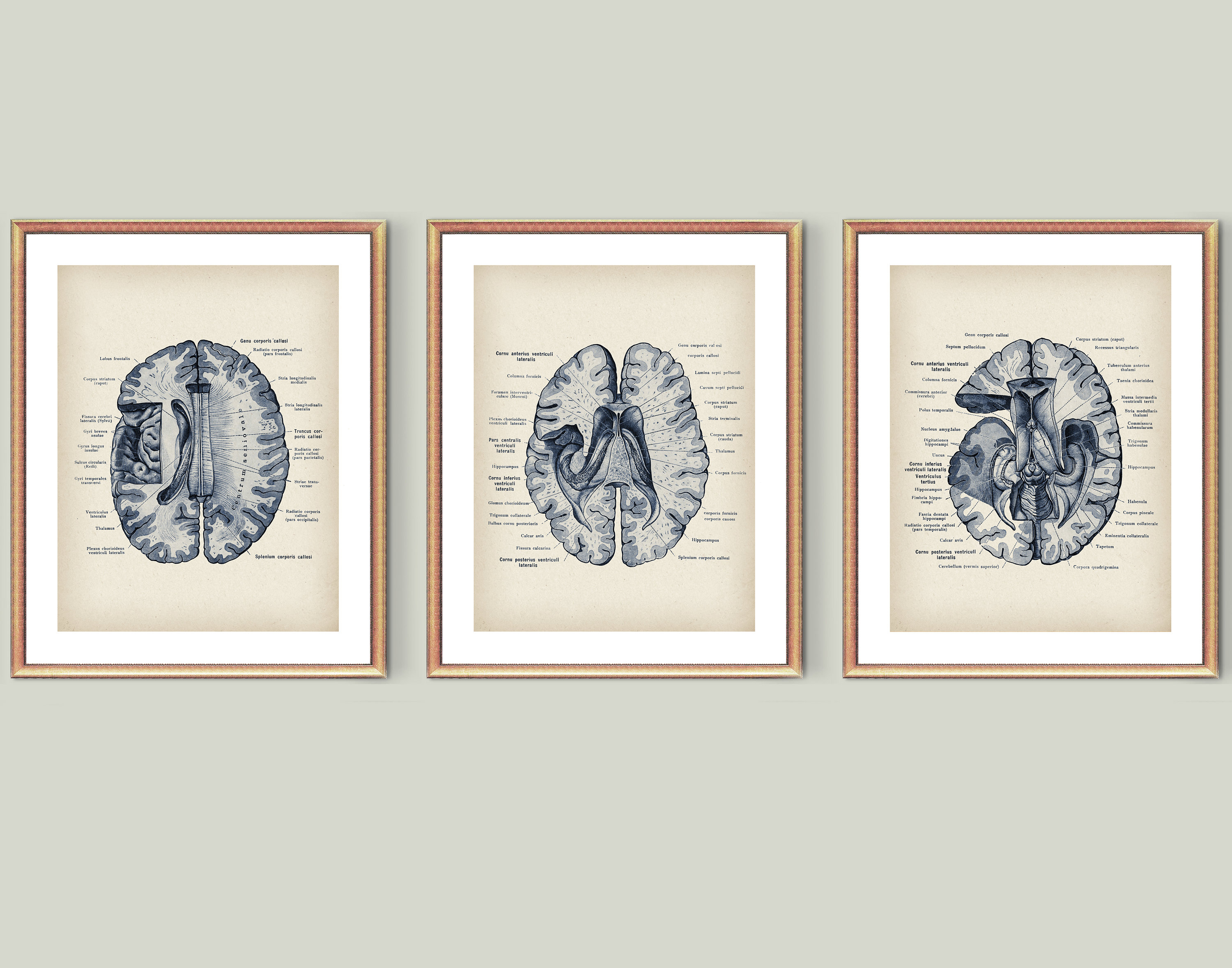 3 Brain Anatomy Art Neuroscience Art Brain Cross Section Diagram ...