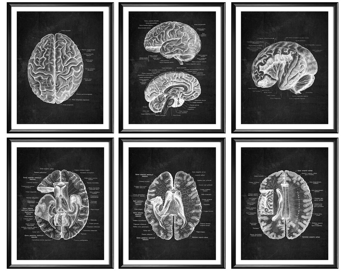 6 Anatomical Brain Posters Neurology Art Medical Art Anatomy Art ...