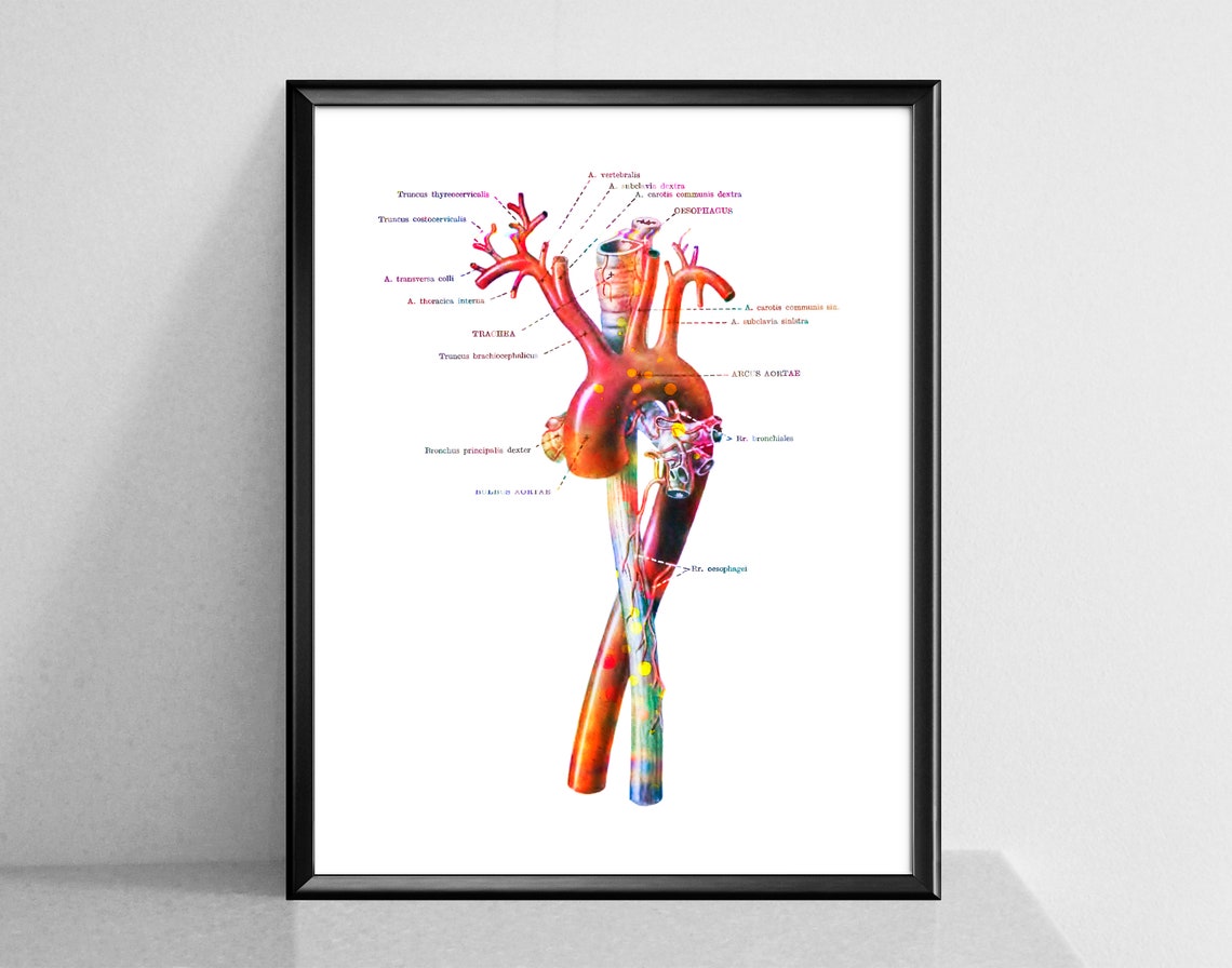 Abdominal Aorta Poster Aorta Anatomy Art Medical Anatomy Art - Etsy