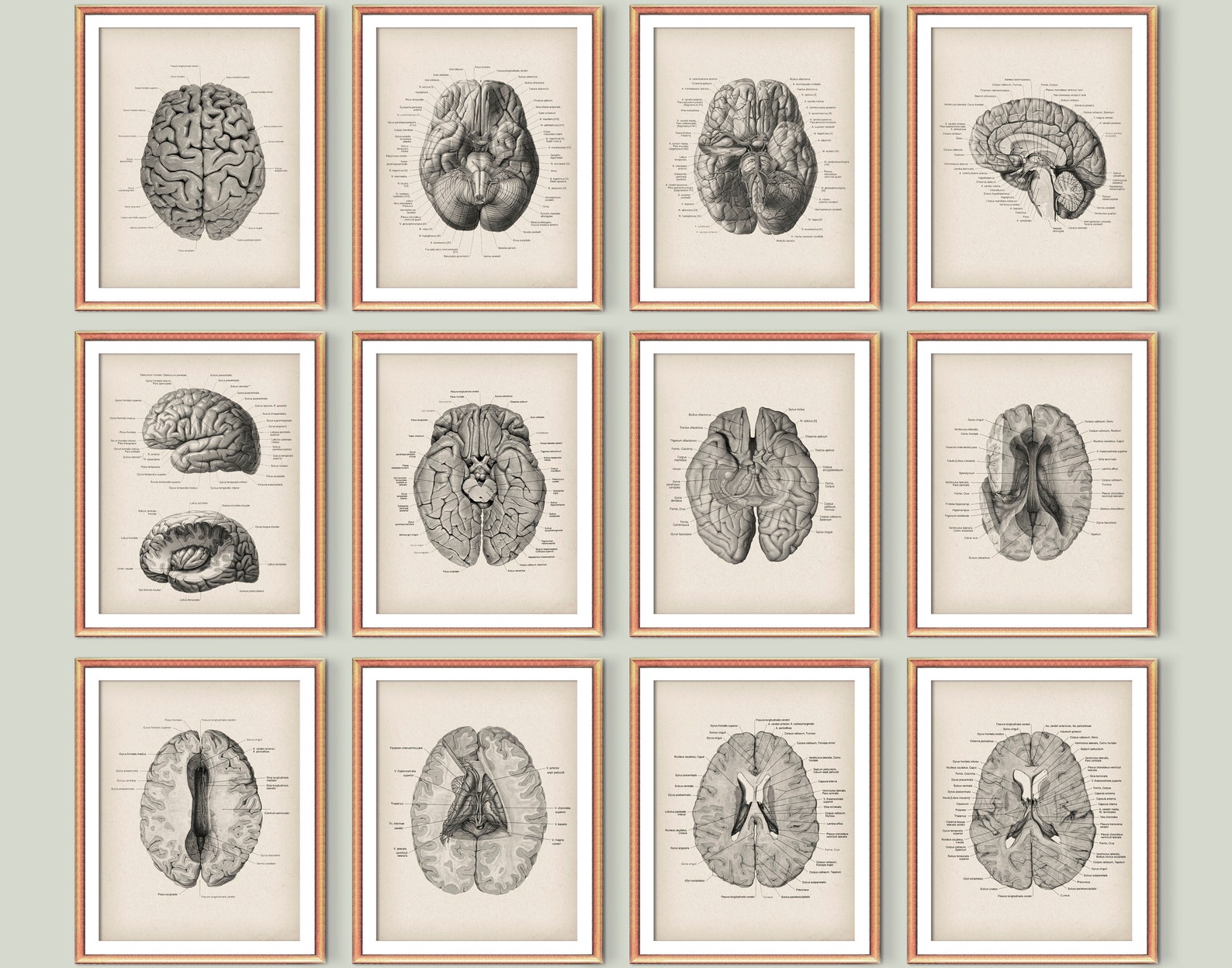 Set 12 Anatomical Brain Posters Neurology Art Vintage Medical - Etsy